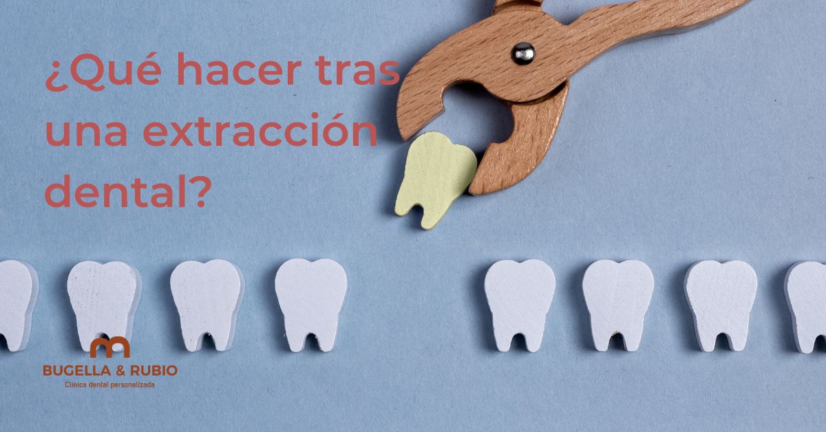 ¿Qué hacer tras una extracción dental? | Clínica dental Bugella & Rubio