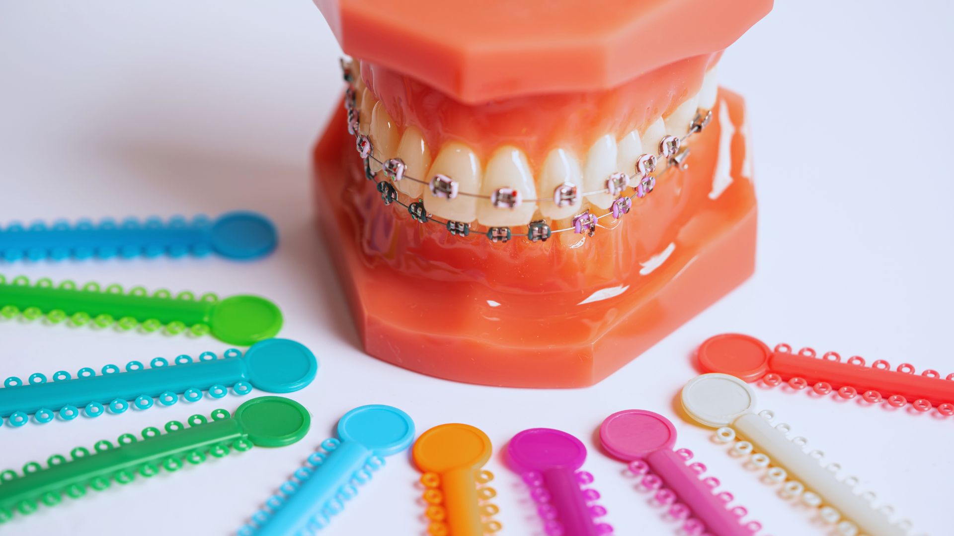 Cómo cuidar tus dientes cuando tienes ortodoncia
